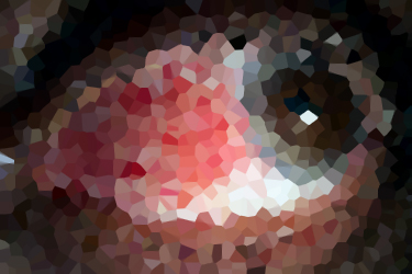 Episcleritis - College of Optometrists