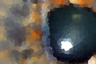 Fuchs endothelial corneal dystrophy (FECD) - College of Optometrists