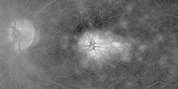 What is new in PCMO? - College of Optometrists