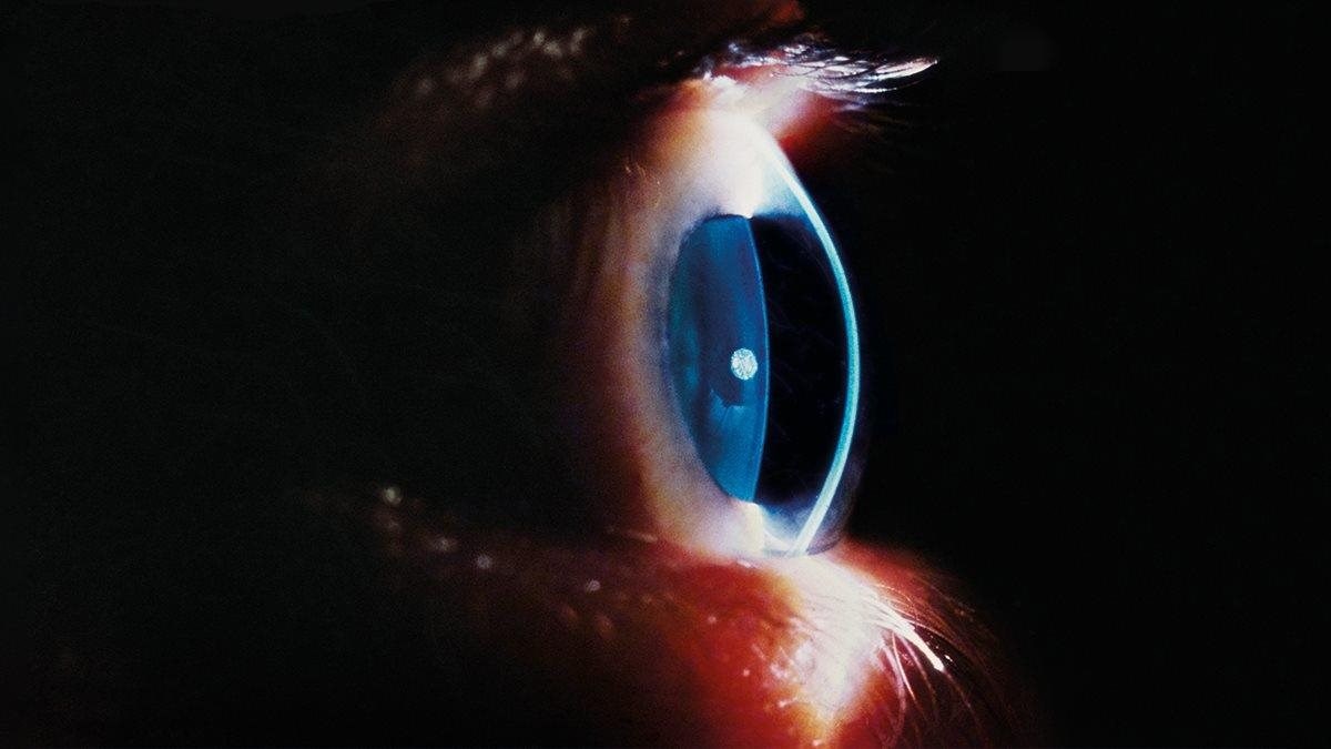 The wonders of the cornea - College of Optometrists