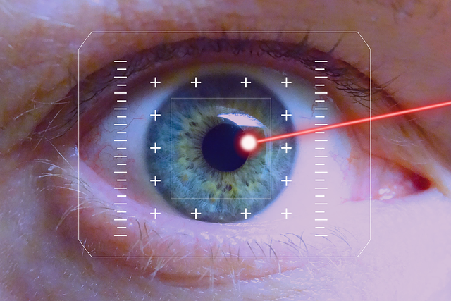 Selective laser trabeculoplasty (SLT) case study - College of Optometrists