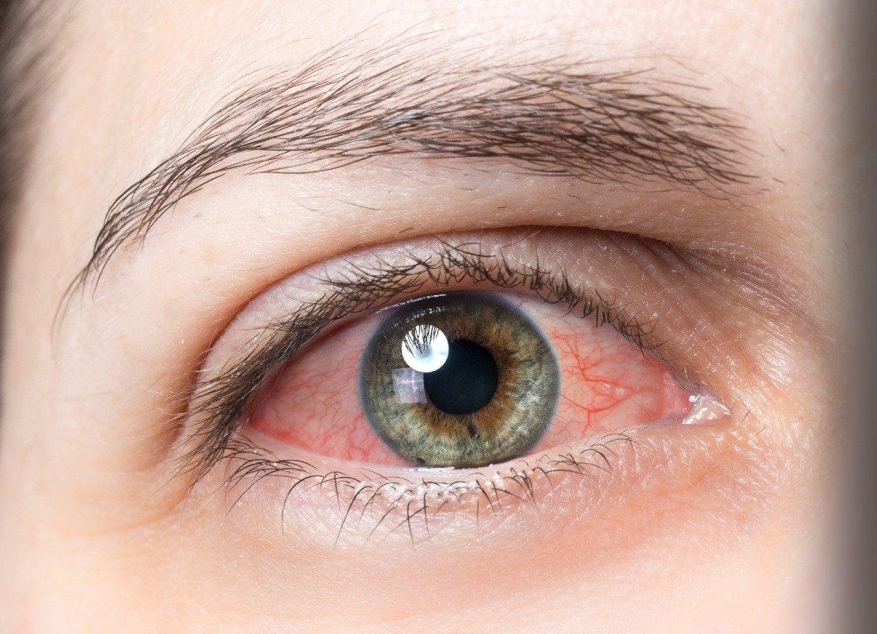 New standard clinical specification to enhance access to minor and ...