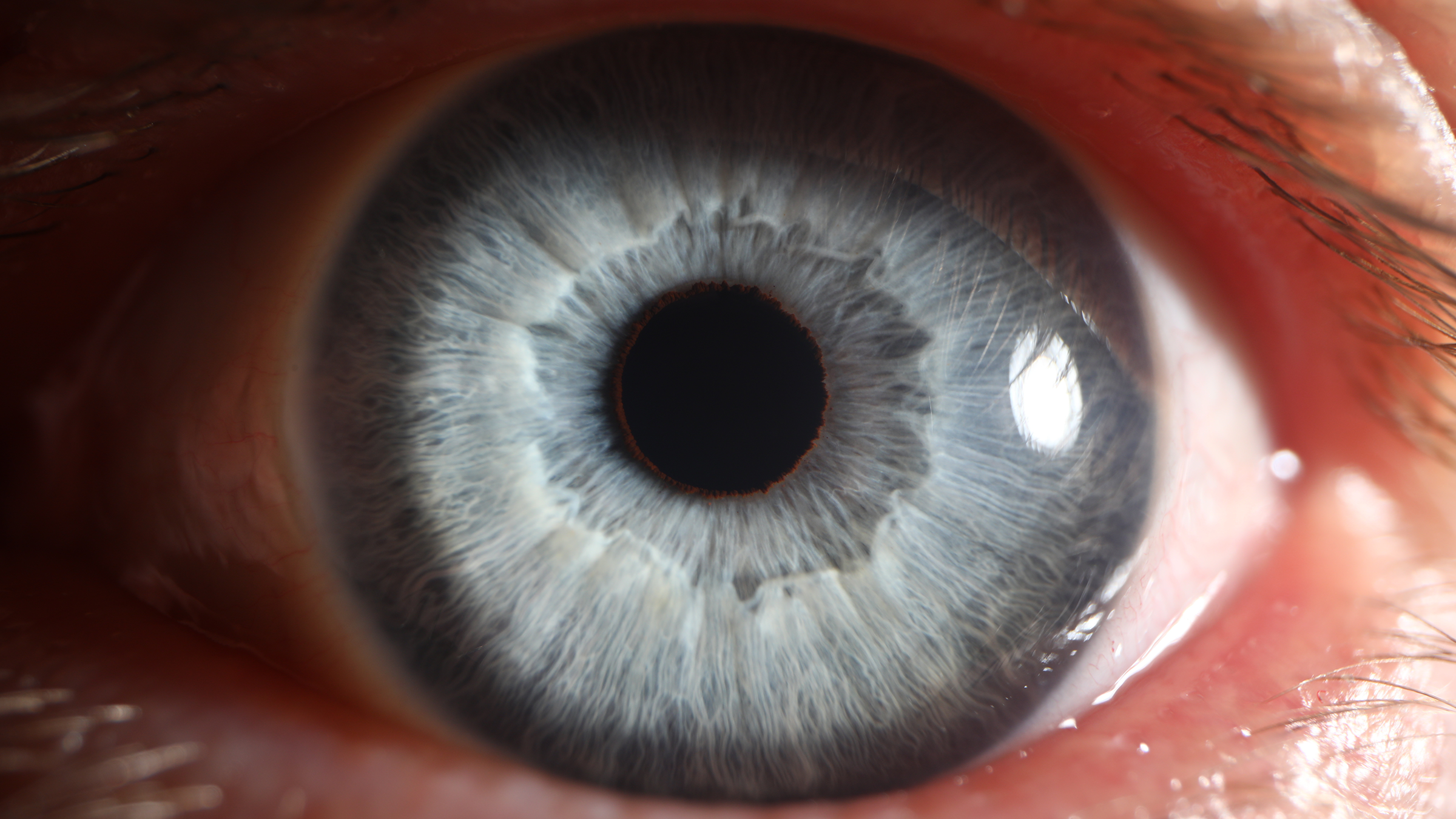 OiP: Managing ocular allergy in optometric practice - College of ...