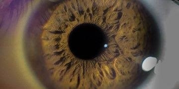 How new understanding of the ocular surface microbiome may affect our ...